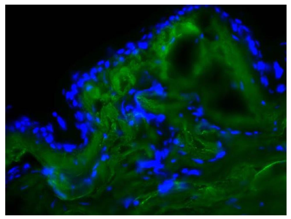 FITC Goat Anti-Type I Collagen | SouthernBiotech